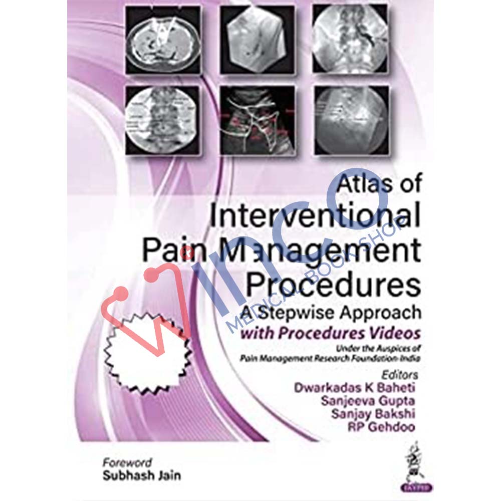 Atlas of Interventional Pain Management Procedures: A Stepwise Approach ...