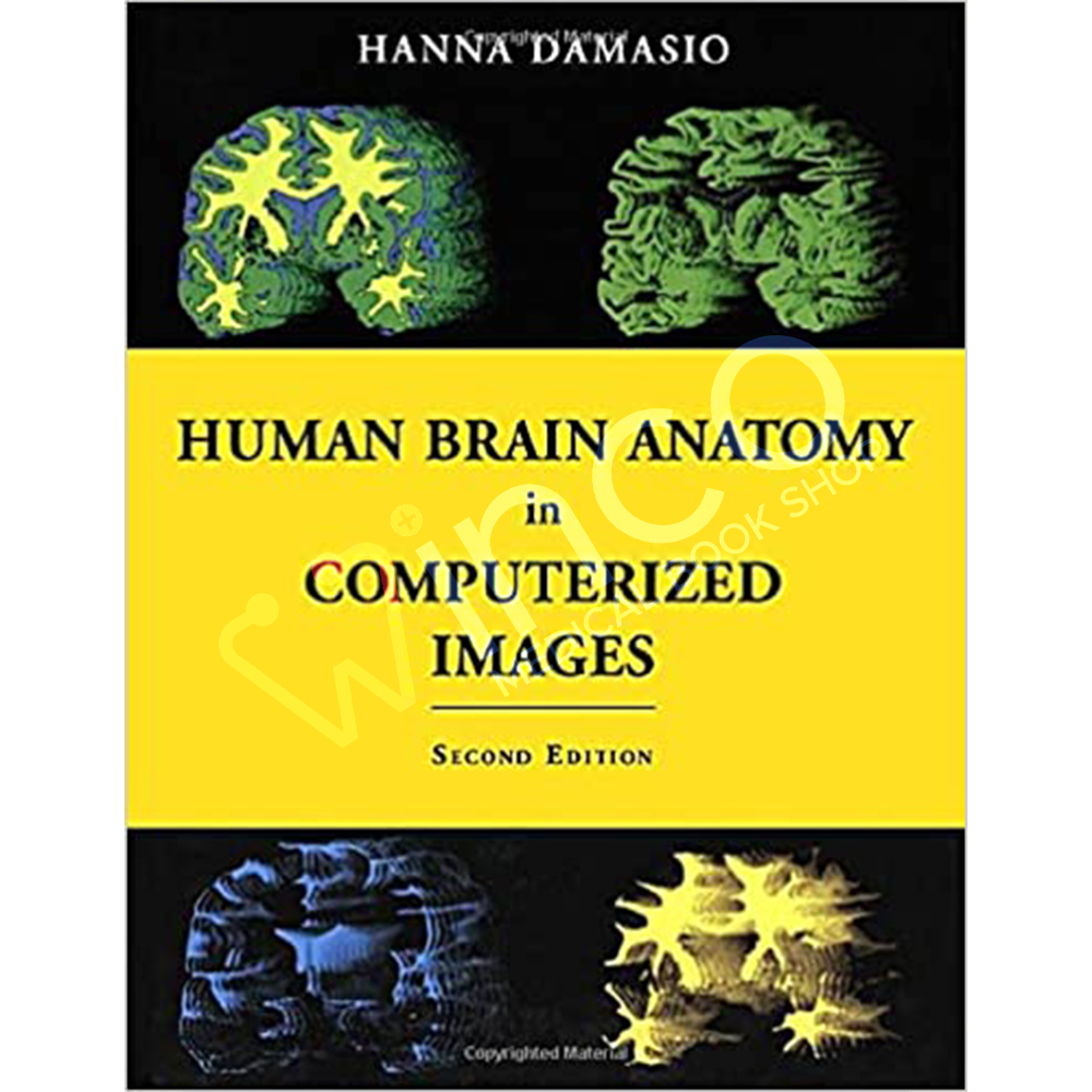 Human Brain Anatomy in Computerized Images 2nd Edition - Winco Medical ...