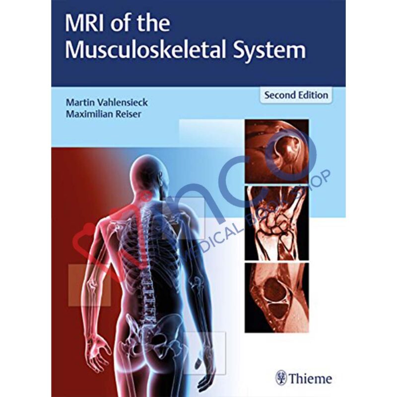 MRI of the Musculoskeletal System 2nd Edition - Winco Medical Book Store