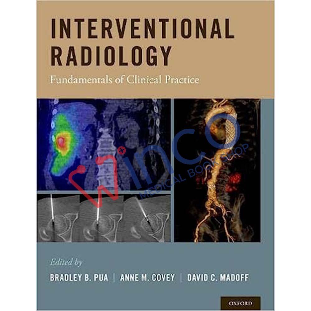 Interventional Radiology: Fundamentals of Clinical Practice 1st Edition ...