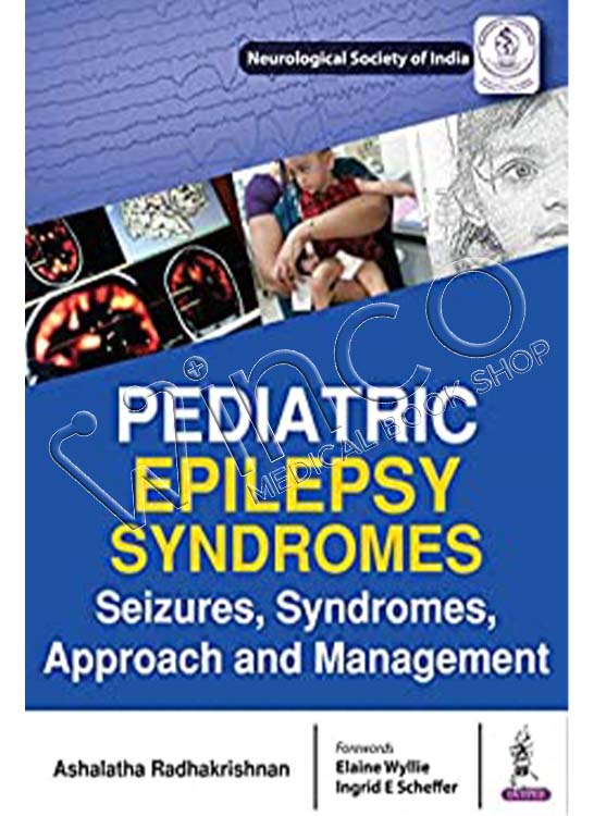 Pediatric Epilepsy Syndromes: Seizures, Syndromes, Approach and ...