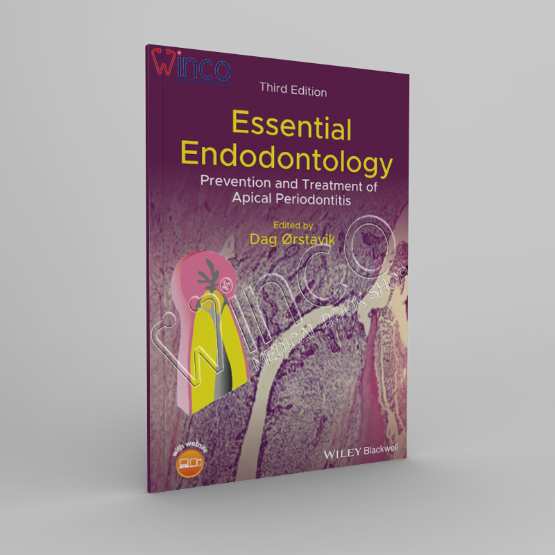 Essential Endodontology 3rd Edition: Apical Periodontitis Treatment ...