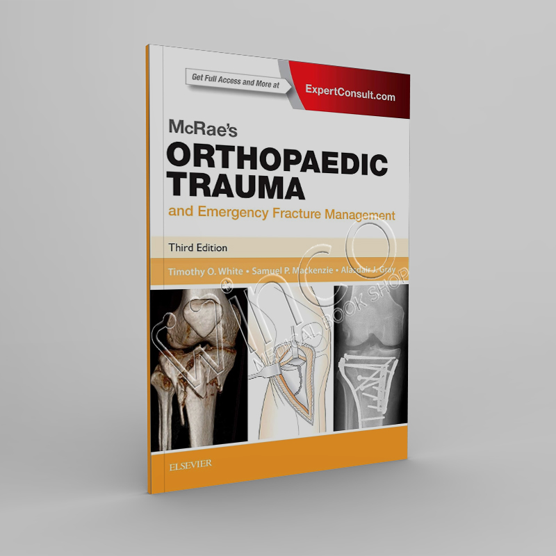 McRae’s Orthopaedic Trauma Management: Fracture care 3rd Ed. - Winco ...